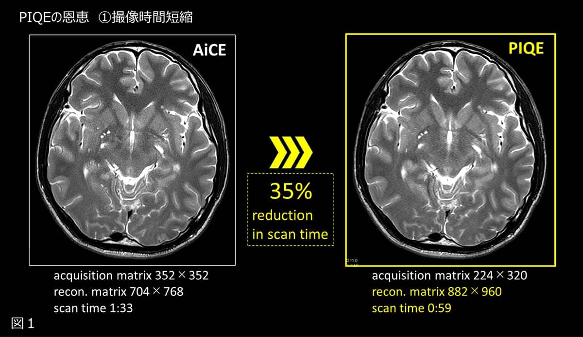 SoftwareVer.9.0がもたらした新たなMRI検査について｜日本医科大学付属病院様｜MRI｜導入事例｜epicus CLUB｜キヤノン ...