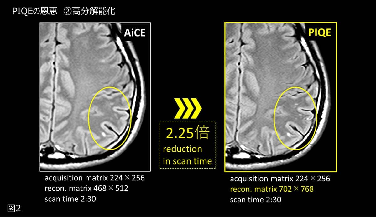 SoftwareVer.9.0がもたらした新たなMRI検査について｜日本医科大学付属病院様｜MRI｜導入事例｜epicus CLUB｜キヤノン ...