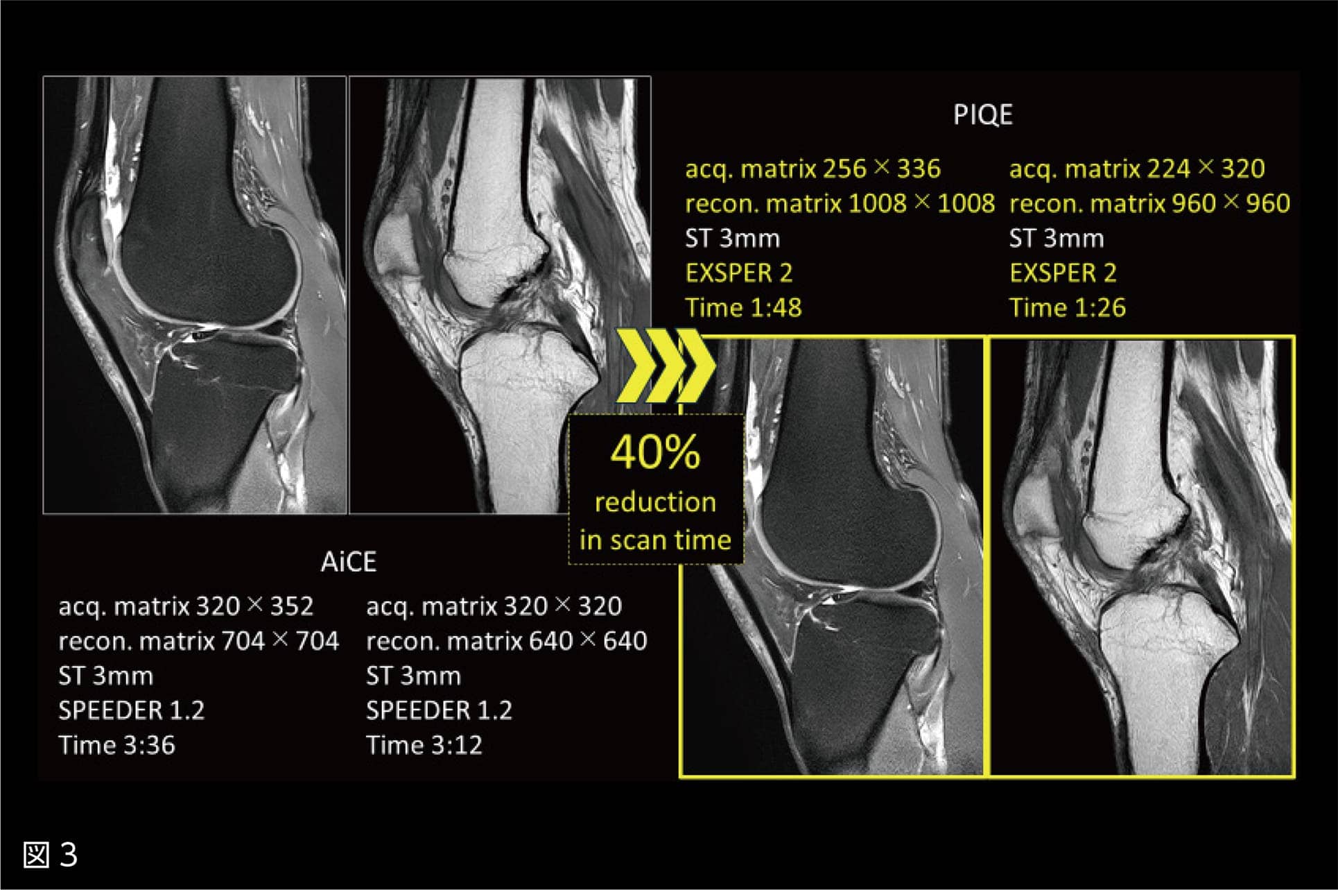 SoftwareVer.9.0がもたらした新たなMRI検査について｜日本医科大学付属病院様｜MRI｜導入事例｜epicus CLUB｜キヤノン ...
